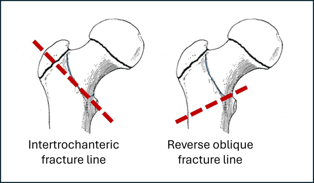 Neck of Femur (NOF) Fractures - Scrub Book